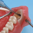 Oral Surgery Area | Oral Surgery Jaw Model [SUG1003-UL-SP-FEM-28]
