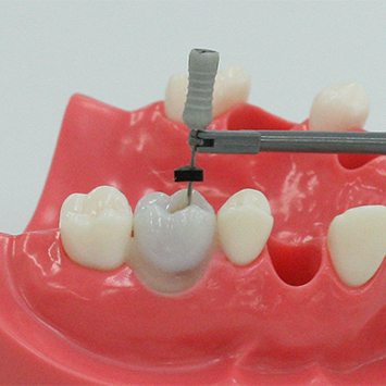 Tooth Model | Anatomical Pulp Cavity & Root Model [B22X Series]