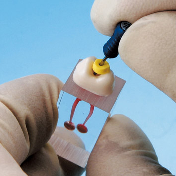 Endodontics Area | Root Canal Model [S7 Series]