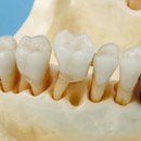 Periodontal Surgery Area | Periodontal Jaw Model [PER1001-UL-SP-FEM-32 ...