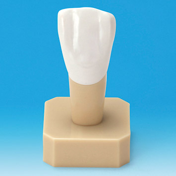 PROSTHODONTICS (PRO) | PATIENT EDUCATION MODEL [PE-PRO003]